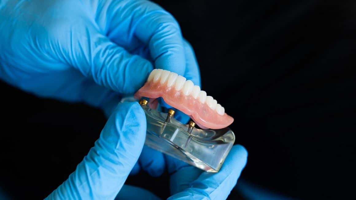 Laboratoire dentaire : Qu'est-ce qu'une prothèse adjointe